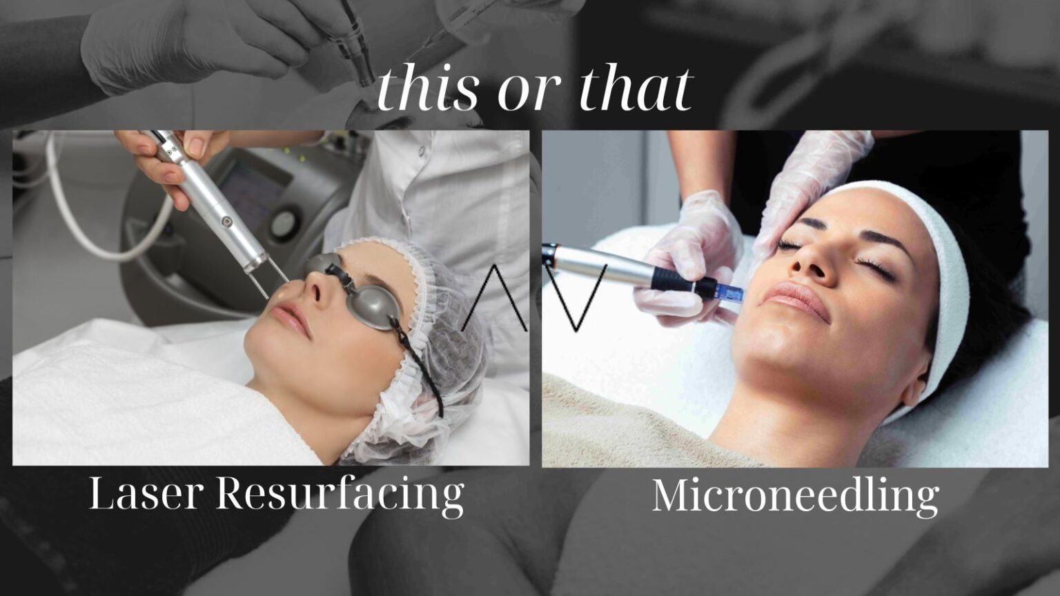 Laser Skin Resurfacing vs Microneedling: Which Skin Renewal Treatment ...